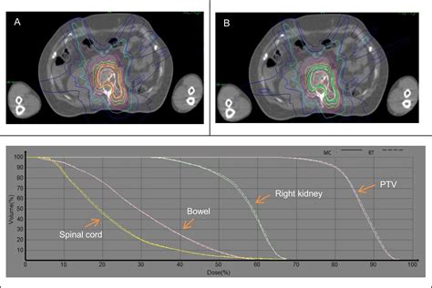 frontiers comparison of ray tracing and monte carlo calculation