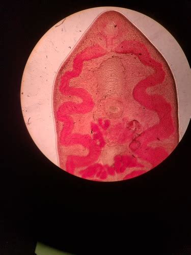 Class Trematoda Lab 3 Flashcards Quizlet