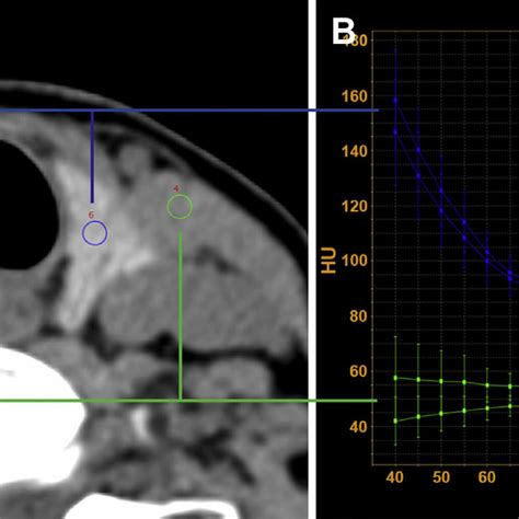 Pdf Dual Energy Computed Tomography