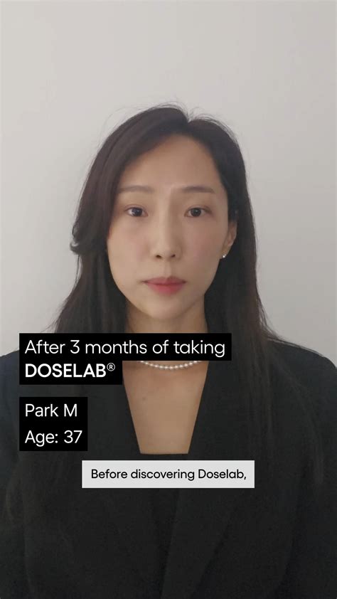 Doselab® Doselabglobal • Instagram Photos And Videos