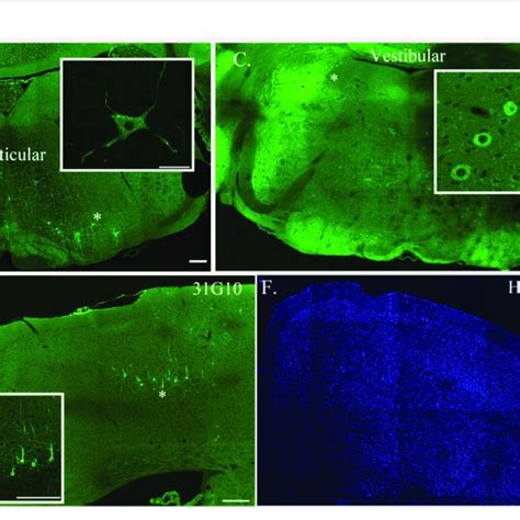 Neurons Located At Specific Anatomical Nodes Are Infected In A