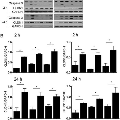 Tnf α Induced Cldn1 Expression Is Regulated Via Pkcδ A Western Blot