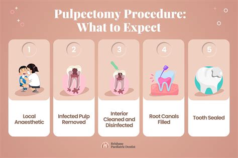 Dental Pulpectomy For Primary Teeth Cause And Treatment