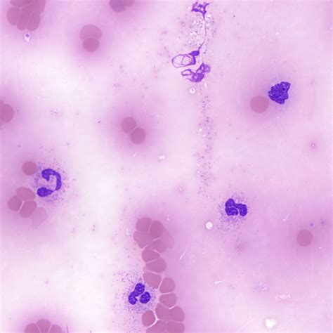 Tile Thickness Classification Dataset By Pbs Wbc