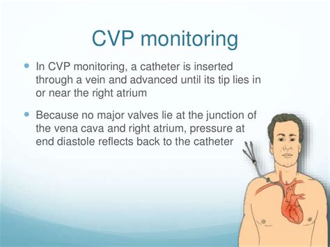 CVP Pulmonary Artery Wedge Pressure Monitoring Physiology