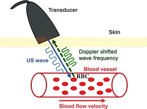 Doppler principle The Doppler shift Δf can be calculated as Download Scientific Diagram