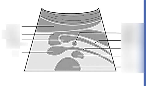 Diagram 2 Diagram Quizlet
