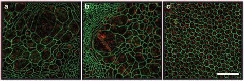 4 Highly Enlarged Cells In The Rpe Sheet Of The P100 Rd10 Mouse Green Download Scientific
