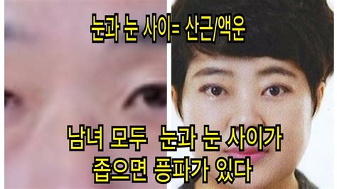 남녀 모두 눈과 눈 사이가 움푹하면 좋지 못하다 Youtube