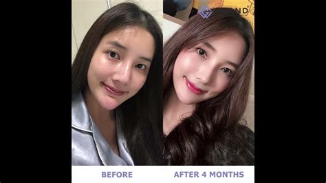 [ГРАНД ГОО САЙХНЫ ЭМНЭЛЭГ][МЭС ЗАСЛЫН ӨМНӨХ БОЛОН ДАРААХ] Youtube