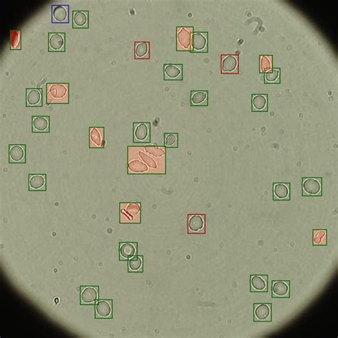 Cell Detection Classification And Diagnosis Result Of The Framework