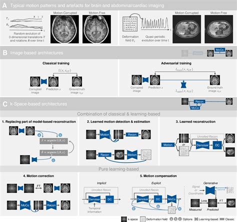 Deep Learning For Retrospective Motion Correction In Mri A Comprehensive Review