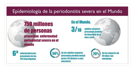 Gingivitis Clasificación Síntomas Y Tratamiento