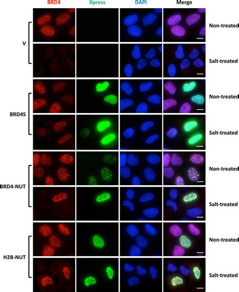 Visualization Of The Tighter Brd4 Chromatin Binding Induced By The Nut Download Scientific