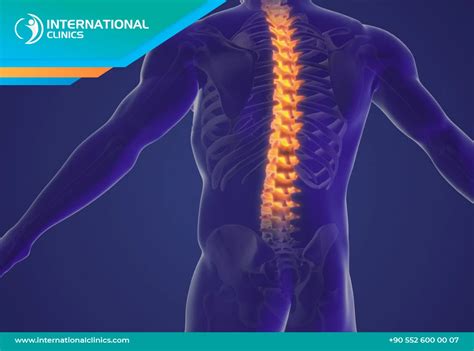 Spinal Fusion Surgery Understanding Types Complications And Recovery
