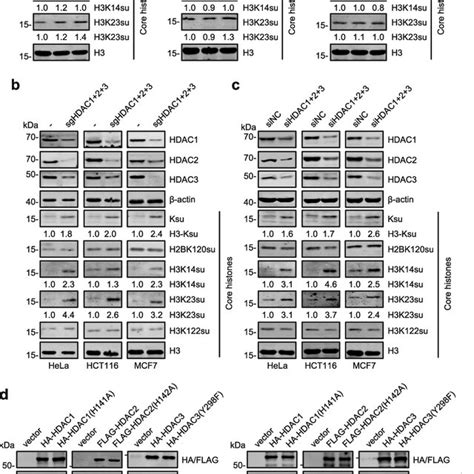Marked Elevation Of Histone Succinylation By Inhibition Of Hdacs But Download Scientific