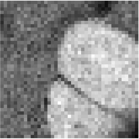 Reconstructions And Segmentation For Real Mri Data The Image Show A Download Scientific