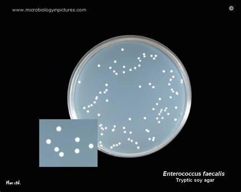 Enterococcus Faecalis On Tryptic Soy Agar Tsa Colonies Of