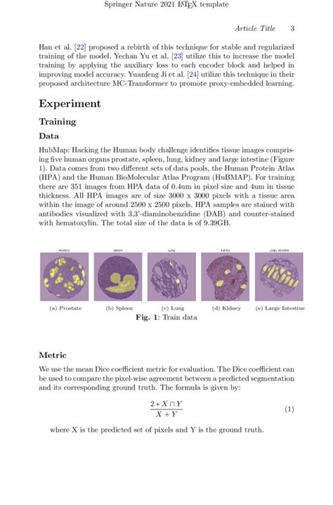 Switched Auxiliary Loss For Robust Training Of Transformer Models For