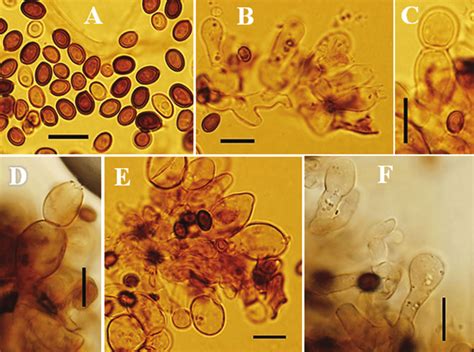 Agaricus Subrufescens Vm098 Basidiospores A Basidia B And Download Scientific Diagram