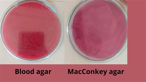 Staphylococcus Aureus Morphology Virulence Factors Lab Diagnosis Notesmed