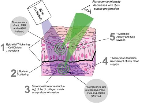 Fluorescence Spectroscopy In Oral Cancer At Sebastian Montefiore Blog