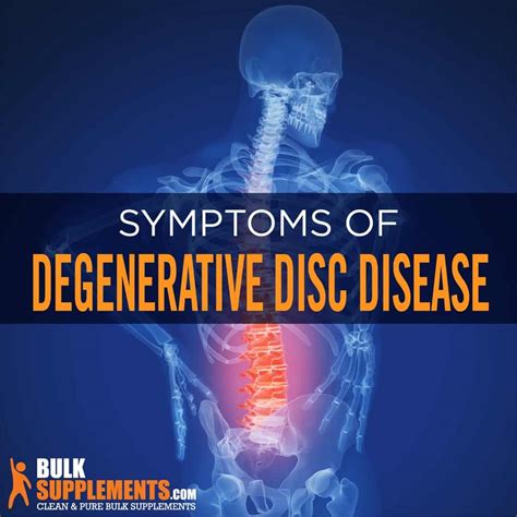 What Does Multilevel Degenerative Disease Mean At Stanley Luna Blog