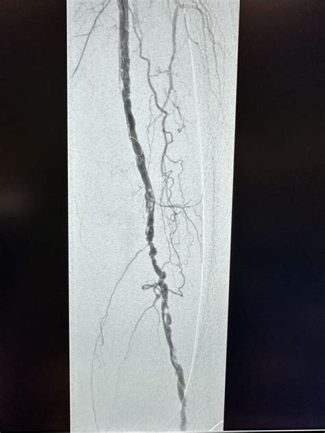 Alexandre Araujo Pereira On Linkedin 101 Yo Female Rutherford 5 Cli