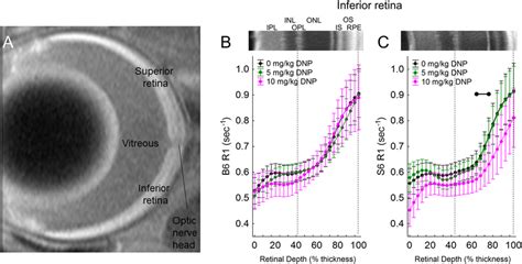 Spatial Resolution Of Retina