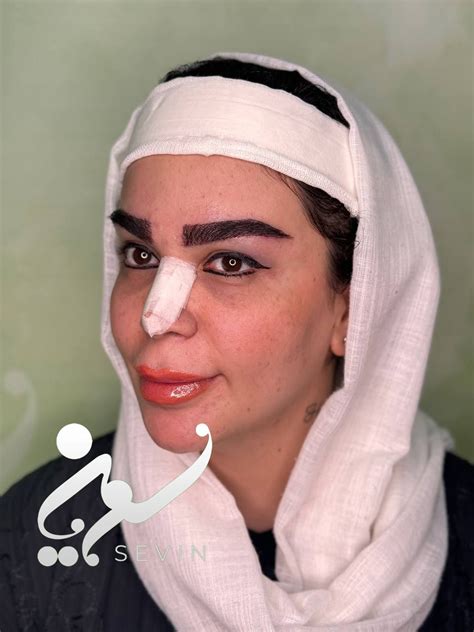 کلینیک سوین درمانگاه تخصصی پوست و مو کاشت ابرو