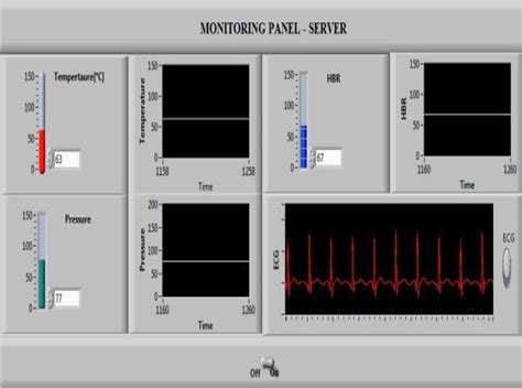 Figure 6 From Biomedical Parameters Monitoring And Sharing On Tcpip