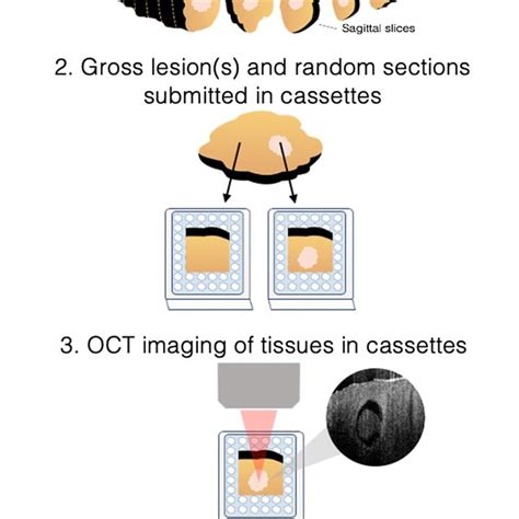 Schematic Of The Pathology Imaging System A Uhs Oct Interferometer Download Scientific