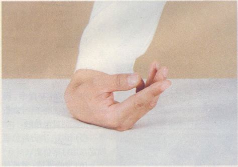 㨰法 中医学 医学