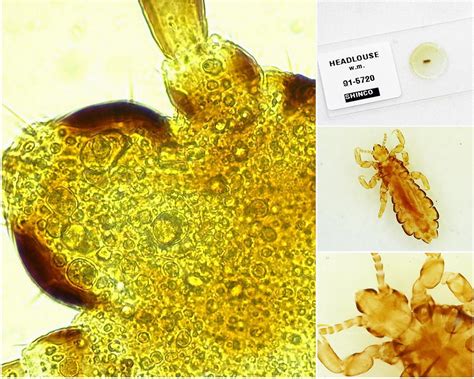 Magnification Examples — Dino Lite Digital Microscope Americas