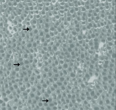 Scanning Electron Micrograph ×1000 Of Dentin Sample Treated With 37 Download Scientific