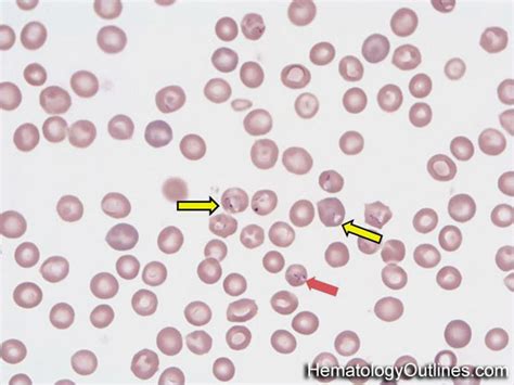 Hematologyoutlines Atlas