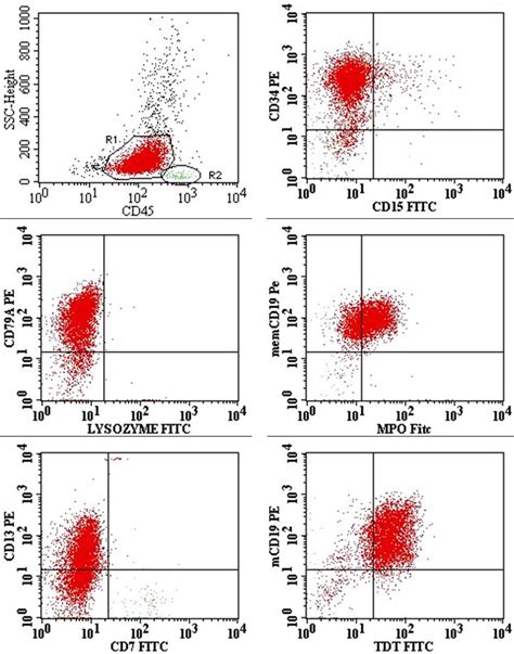 Dot Plots With The Blast Population Highlighted In Red R1 And