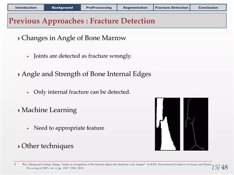 Master Thesis Long Bone Segmentation And Fracture Detection In X Ray