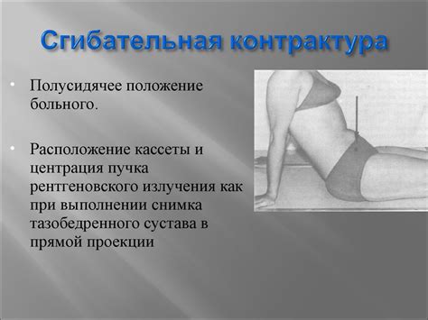 Рентгенологическое исследование тазобедренных суставов презентация онлайн