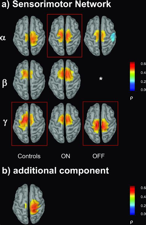 Sensorimotor Eeg Network A Sensorimotor Network Bestfitting