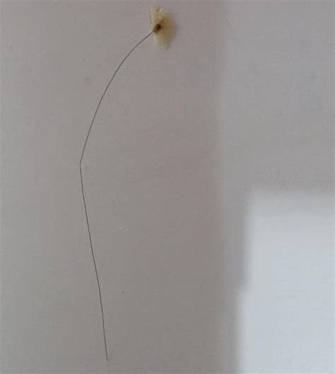 Cant Get Rid Of Dandruff Rdandruff