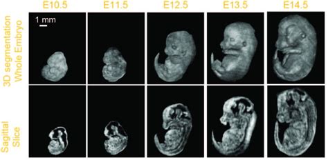 In Utero Mouse Embryo Phenotyping With High Frequency Ultrasound Department Of Radiology
