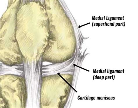 Mcl Sprain Symptoms Treatment Exercises And Rehabilitation