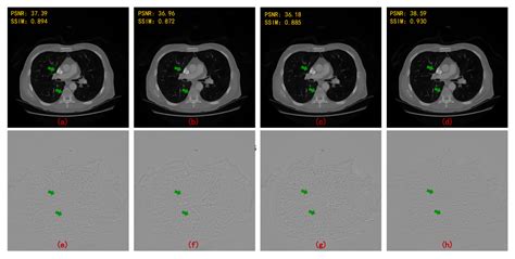Sparse View Ct Reconstruction Based On A Hybrid Domain Model With Multi Level Wavelet Transform