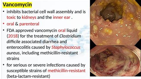 Penicillins And Vancomycin Antibiotics Ppt Ear Nose And Throat Conditions Diseases And
