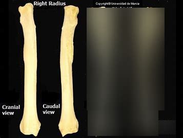 Radius Diagram Quizlet