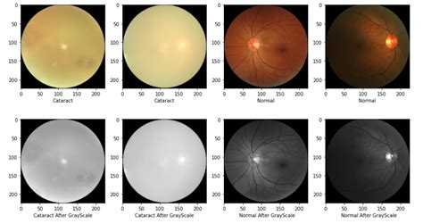 Cataract Detection Using Ml Lets Create An Ml Model To Classify An
