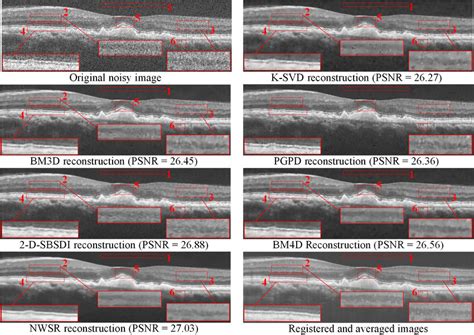 Visual Comparison Of The Denoised Images By Ksvd 41 Bm3d 34 Pgpd 49