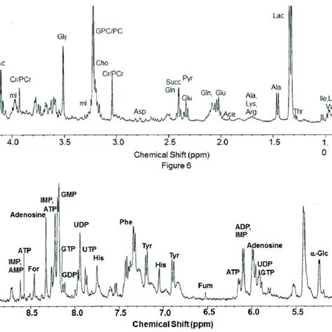 A 1d 1 H Nmr Spectrum Region Showing The Metabolite Resonances From Download Scientific