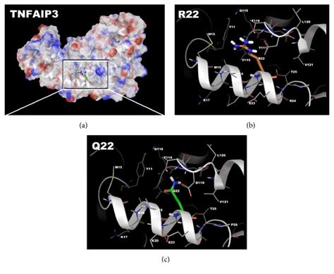 Whole Exome Sequencing And Molecular Modeling Of A Missense Variant In Tnfaip3 That Segregates